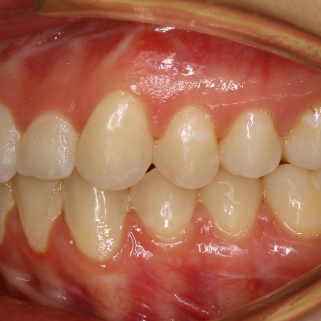 Full Treatment Gallery - PDG Dental